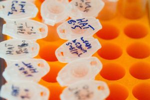 New analysis backs up Veru's move into earlier treatment setting ...